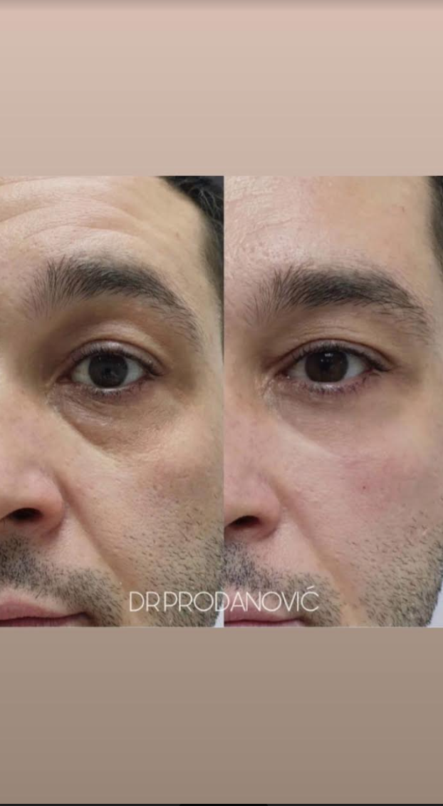 Pre i posle: Dr Srđan Prodanović nam je pokazao kako izgleda najbolji ...