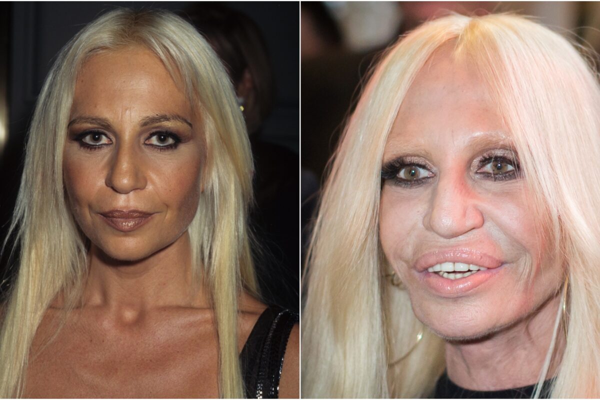 Donatela Versaće je odustala od plastične hirurgije